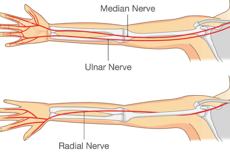 Injured a Nerve in Your Arm? What You Need to Know About Upper Limb ...